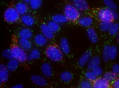 Stellaris® FISH Probe | Mandel Scientific